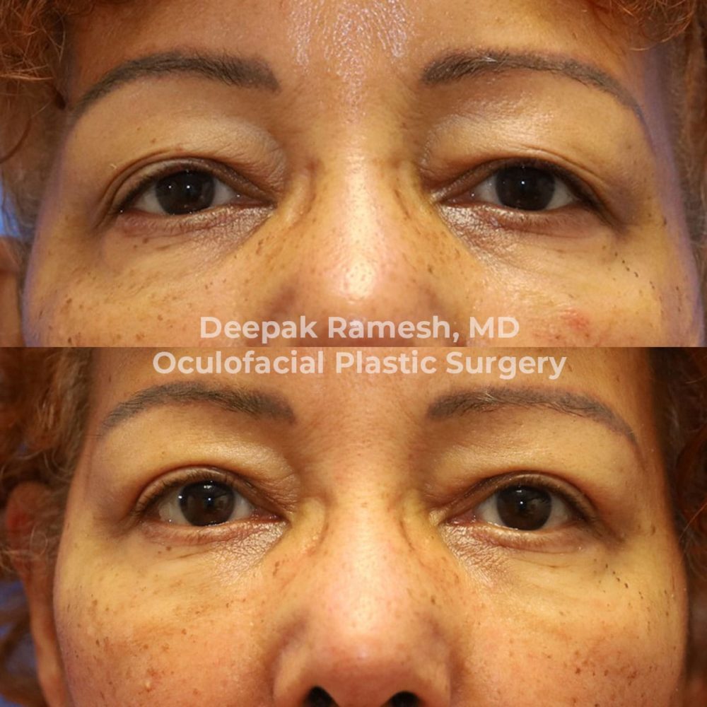 Gallery | Center for Eye & Facial Plastic Surgery in New Jersey