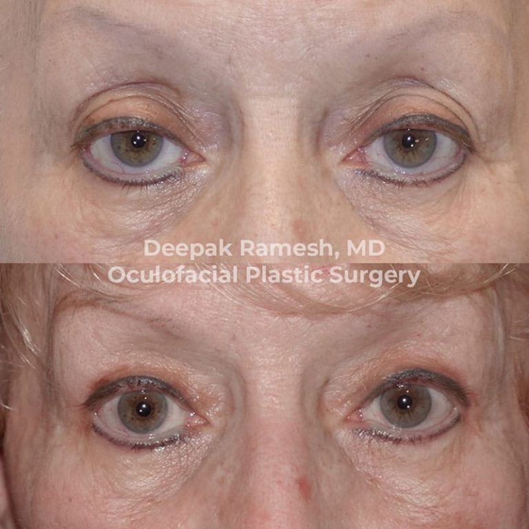 Gallery | Center for Eye & Facial Plastic Surgery in New Jersey