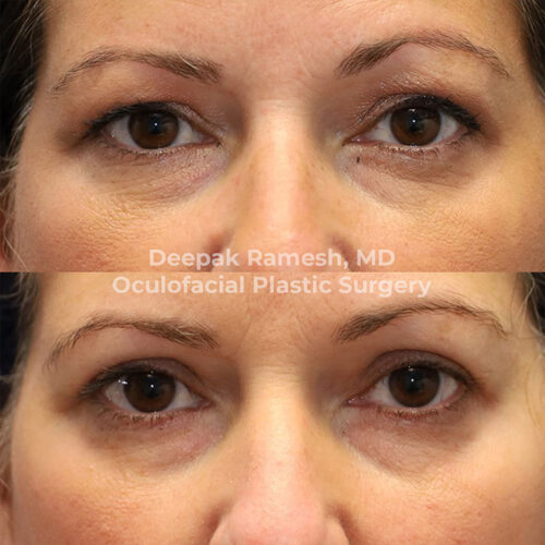 Gallery | Center for Eye & Facial Plastic Surgery in New Jersey