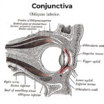 Chemosis New Jersey | The Center for Eye & Facial Plastic Surgery