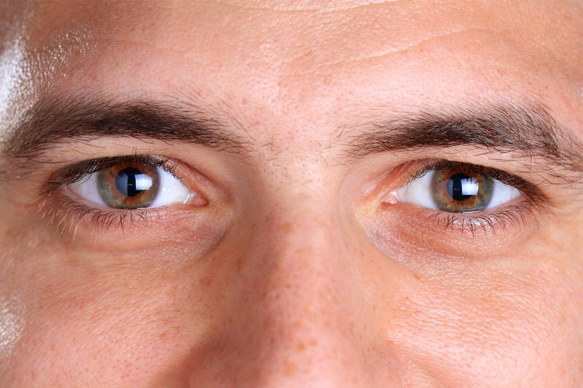 Recovery from Orbital Surgery New Jersey | Center for Eye & Facial Plastics